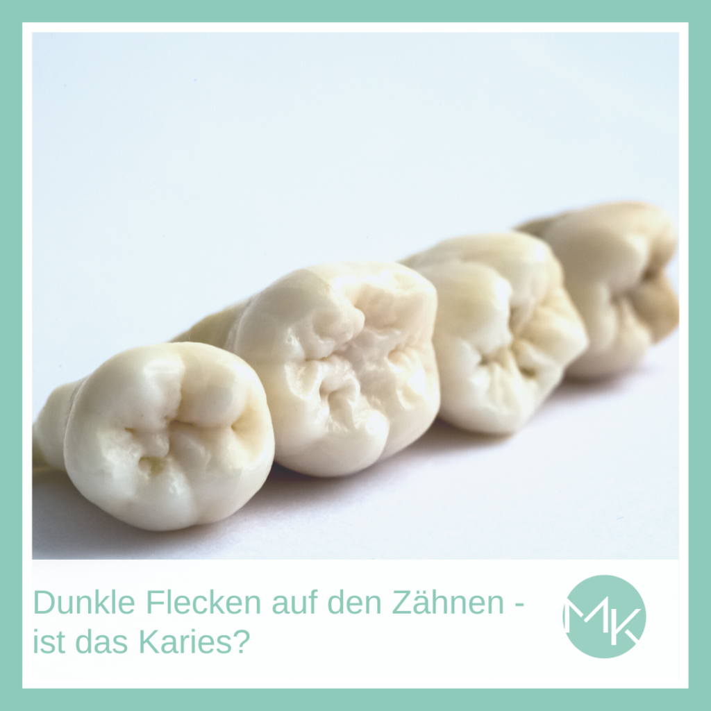 Dunkle Flecken auf den Zähnen - Frau Dr. Marlene Kreißel